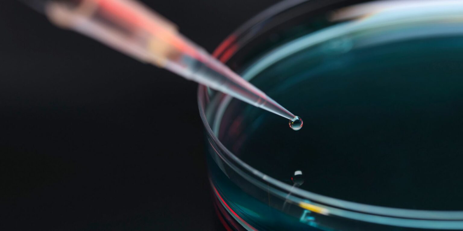 Qu'observer au microscope ? - Microbiology